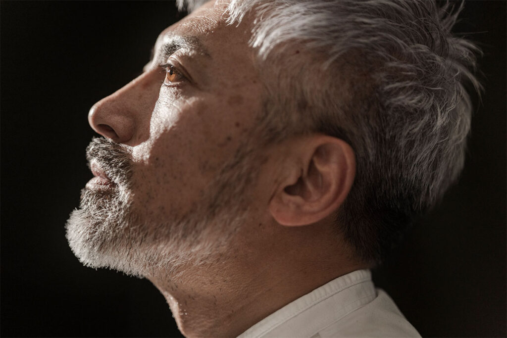 Asian Upper Eyelid Crease Surgery Los Angeles | Dr. David Isaacs